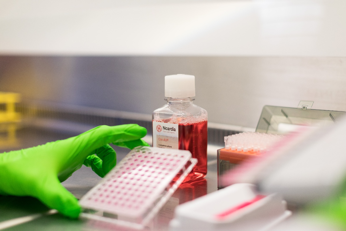 Disease Modeling Services | Ncardia