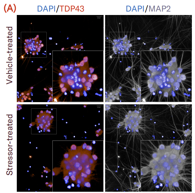 Scientific poster: A human iPSC-based platform to screen therapeutics ...